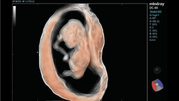 Asset download - Mindray