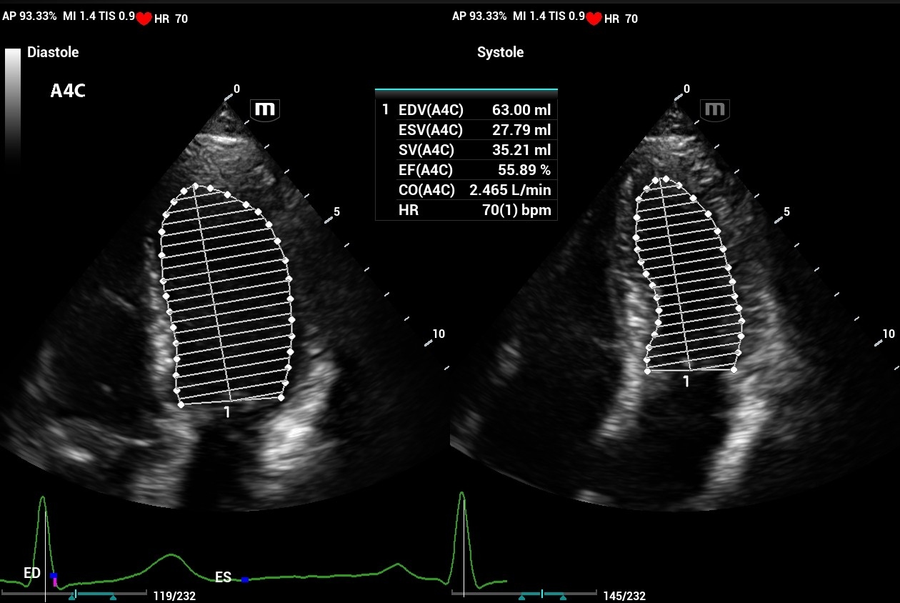 Resona I9 Ultrasound Machine by Mindray