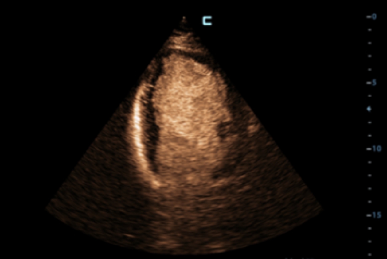 Resona I9T Ultrasound Machine by Mindray