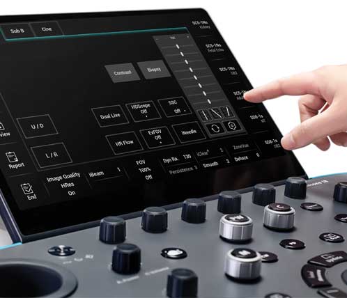 Resona I8 Ultrasound Machine by Mindray