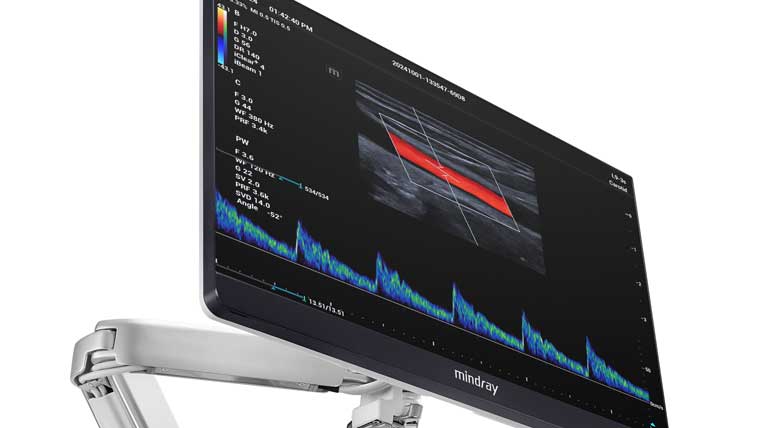 Resona I8 Ultrasound Machine by Mindray