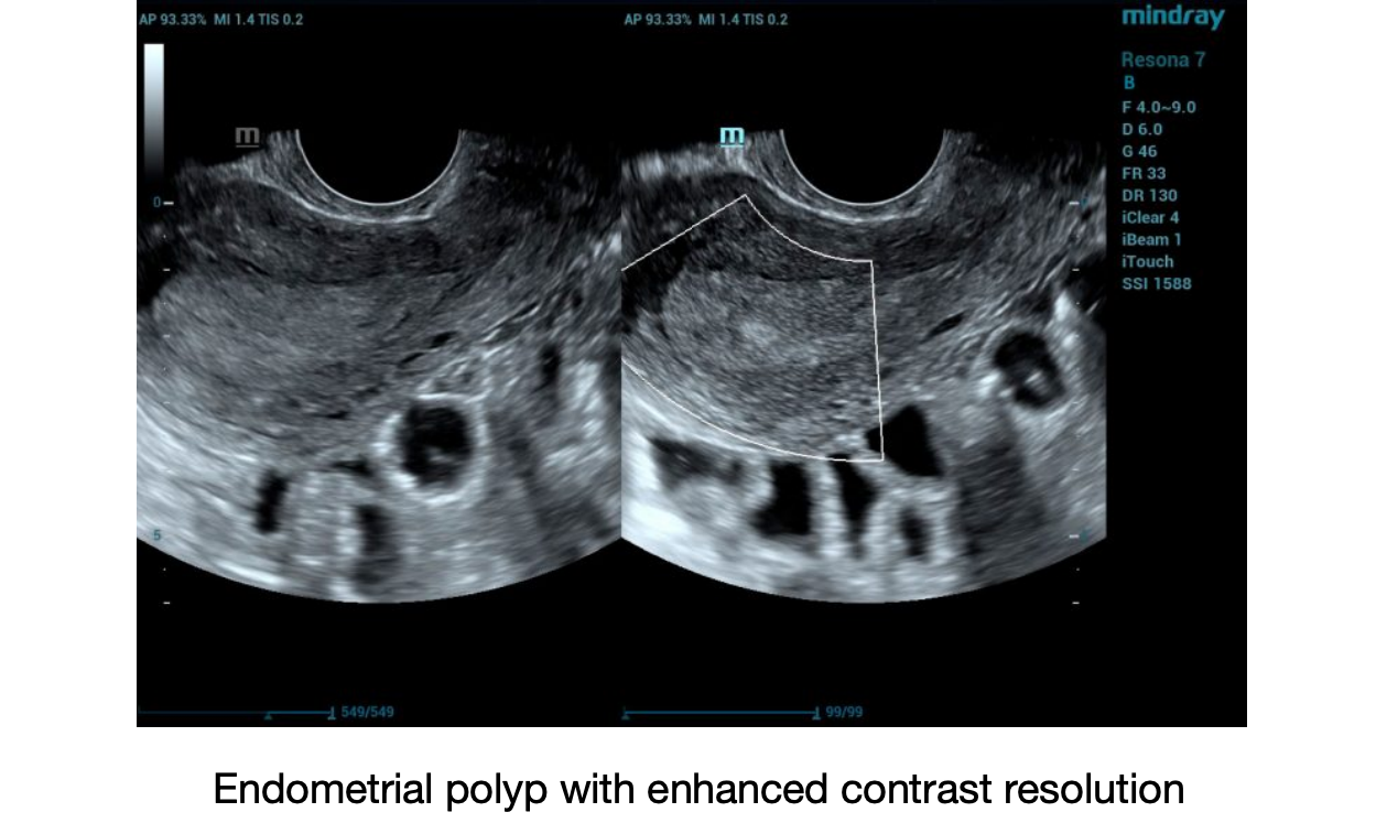Resona 7 - Ultrasound System by Mindray