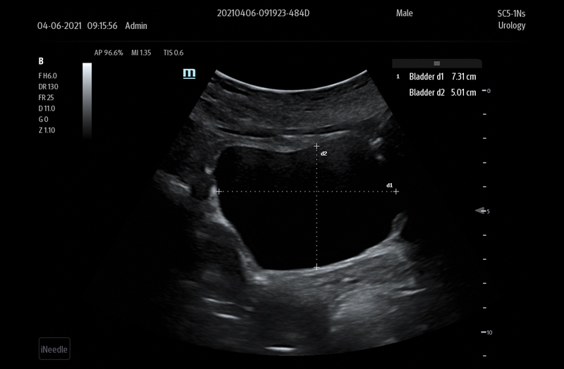 TE7 Max Portable Ultrasound by Mindray