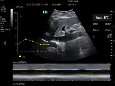 TE7 Portable Ultrasound by Mindray