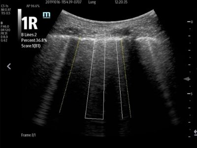 TE7 Portable Ultrasound by Mindray