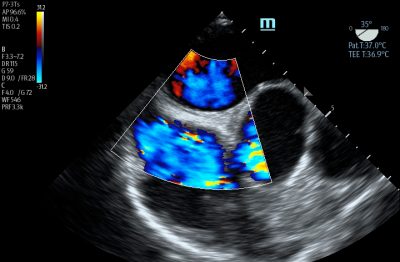 TE7 Portable Ultrasound by Mindray