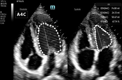 TE7 Portable Ultrasound by Mindray