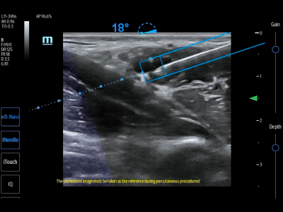 TE7 Portable Ultrasound by Mindray