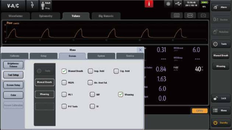 Ventilator - SV800/SV600 - Mindray Français
