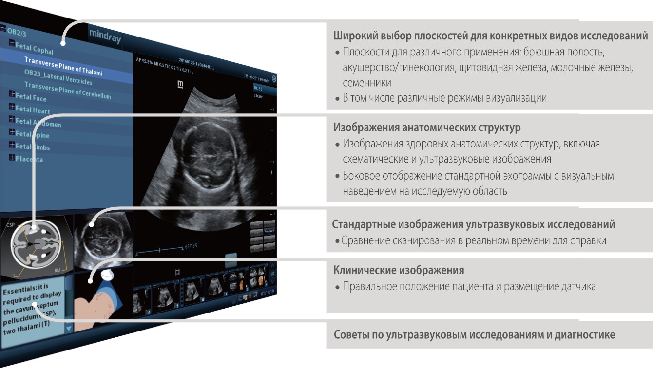 Asset download - Mindray
