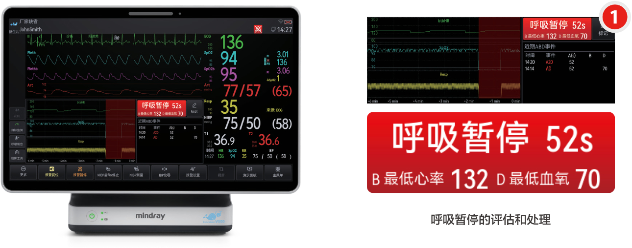 BeneVision V700/V500/V200 Neo 病人监护仪 - 迈瑞医疗