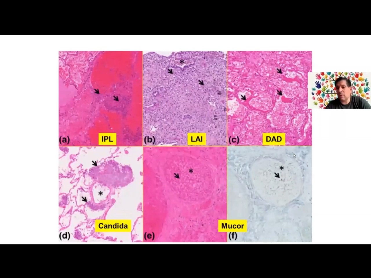 Respiratory Care - Mindray