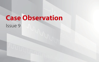 Case Observation 9: Atrial Fibrillation with Long RR Interval Alarm ...
