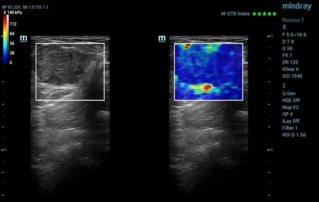 Ultrasound Journal 17 - Multiparametric ultrasound approach in the ...