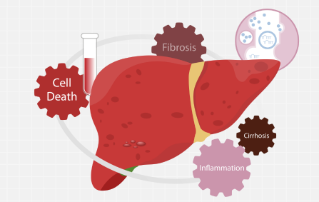 The key clinical biomarkers of liver diseases you should know - Mindray