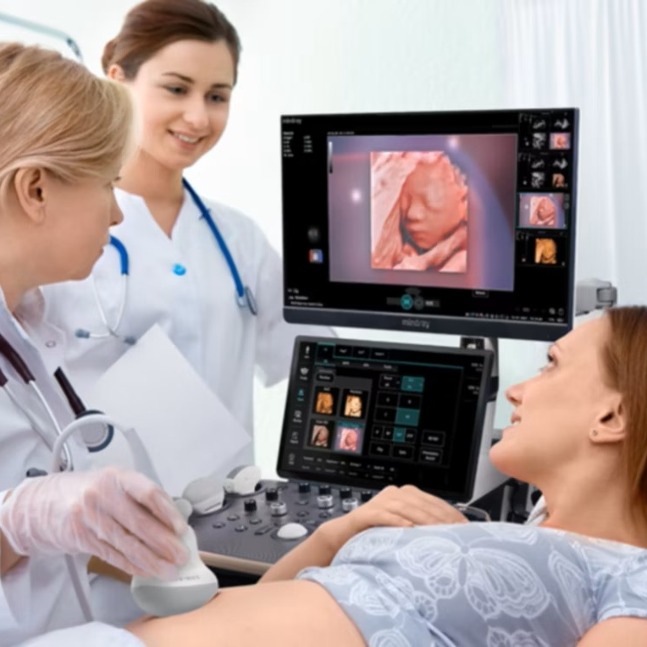 Ultrasound Machines by Mindray