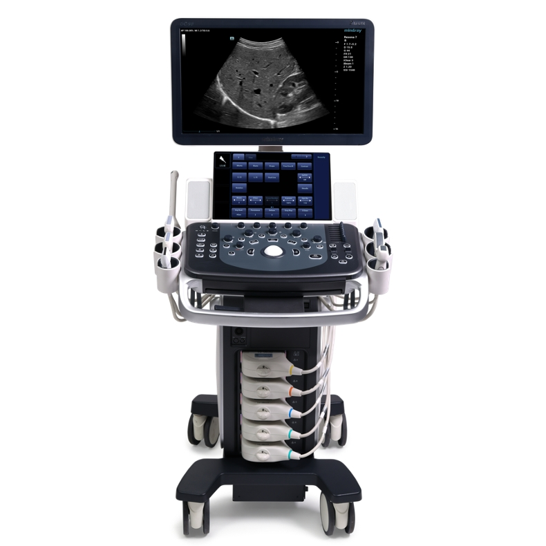 General Imaging Ultrasound Platforms for Healthcare Facilities