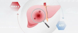 新品上市！PIVKA-II助力肝癌精准诊疗 - 迈瑞医疗